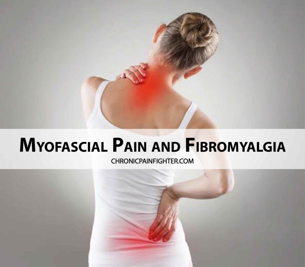 Myofascial Pain and Fibromyalgia